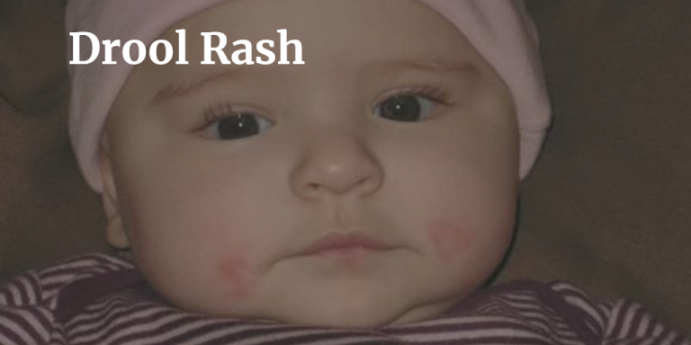 Drool Rash and What You Need to do About it? – Health Linear
